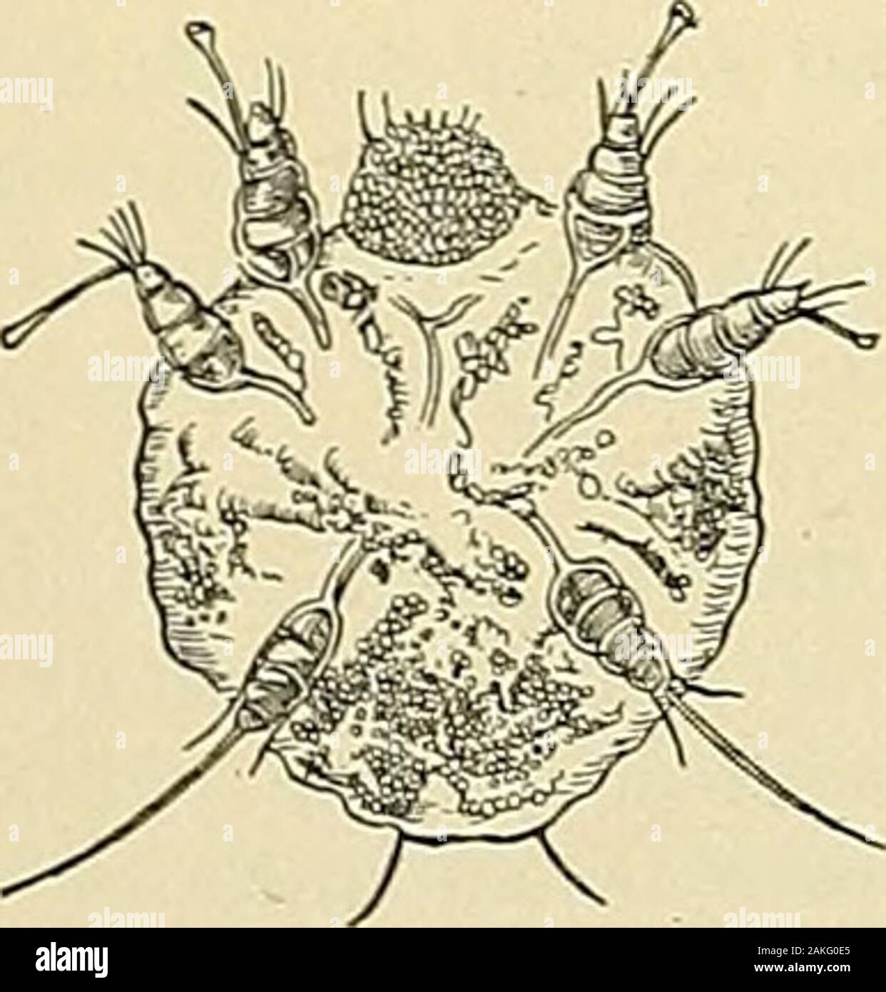 An American text-book of genito-urinary diseases, syphilis and diseases ...
