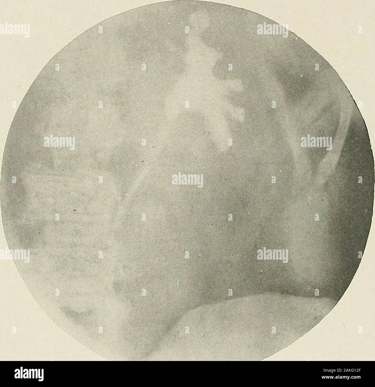 Pyelography (pyelo-ureterography) a study of the normal and pathologic ...