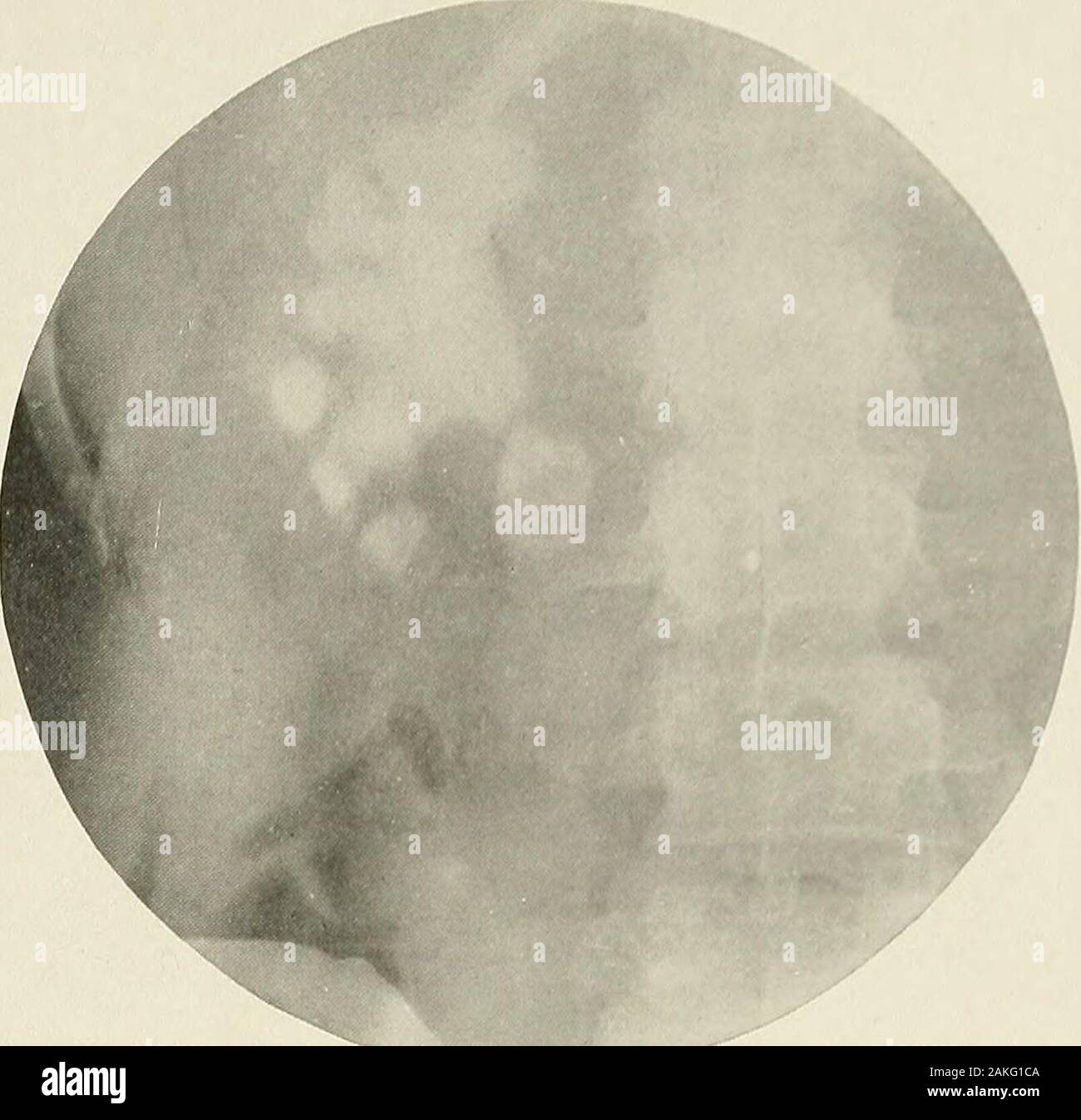 Pyelography (pyelo-ureterography) a study of the normal and pathologic ...