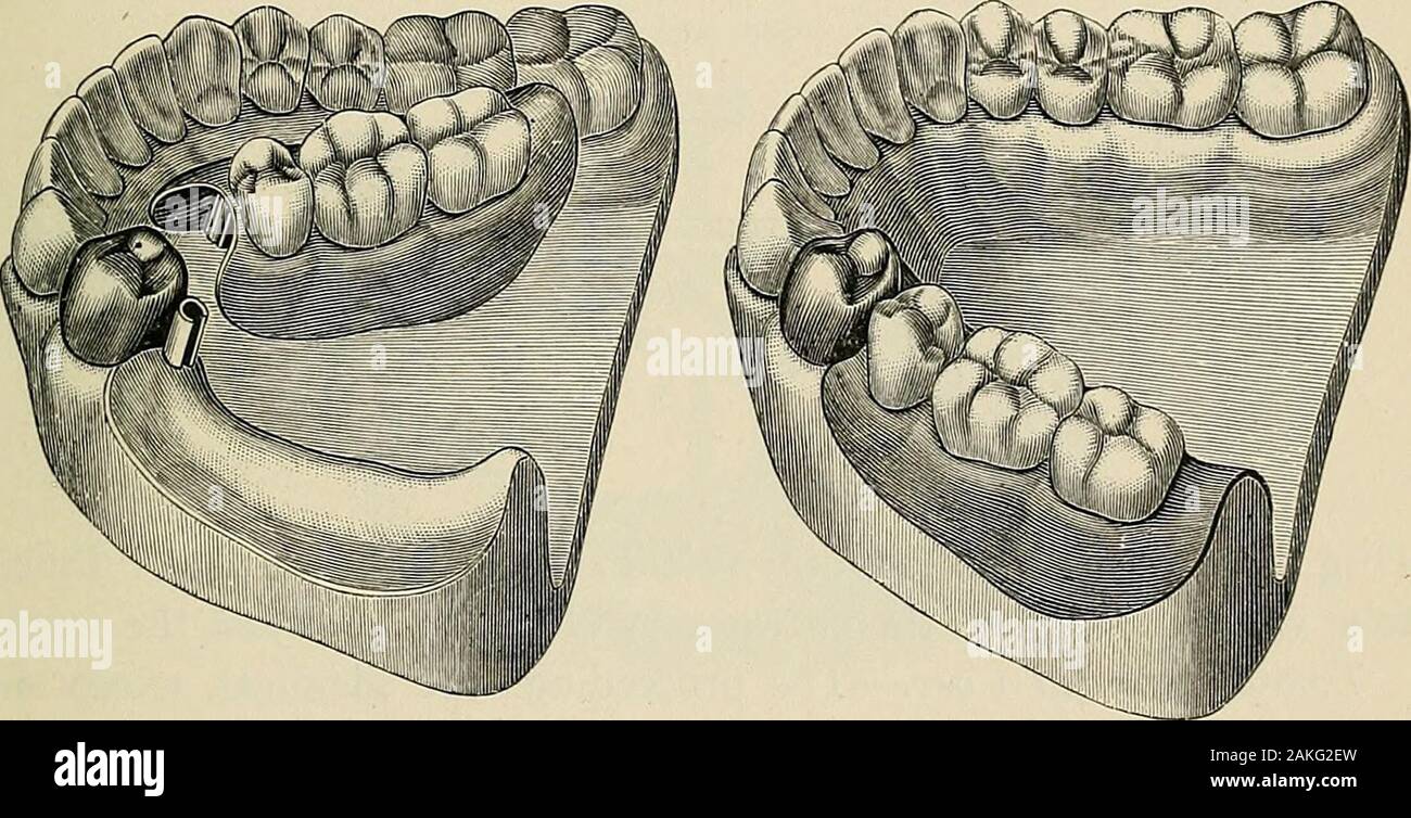 A practical treatise on mechanical dentistry . the position for the ...