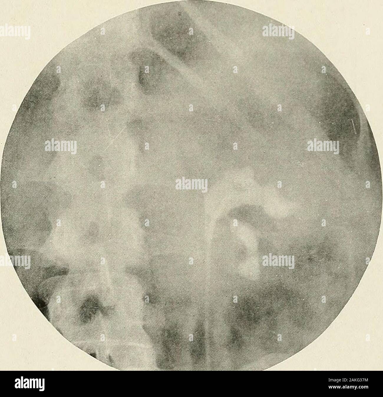 Pyelography (pyelo-ureterography) a study of the normal and pathologic ...
