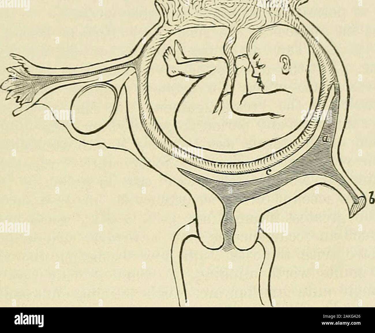 Tubal pregnancy hi-res stock photography and images - Alamy