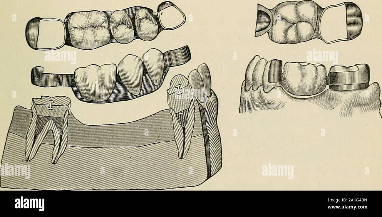 Place of articulation hi-res stock photography and images - Alamy