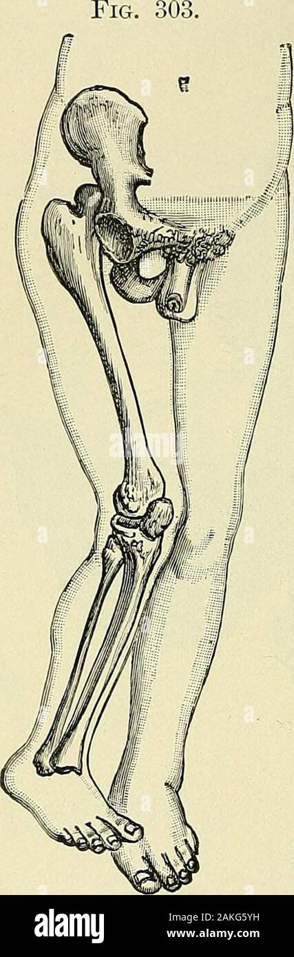 Pelvis rotation hi-res stock photography and images - Alamy
