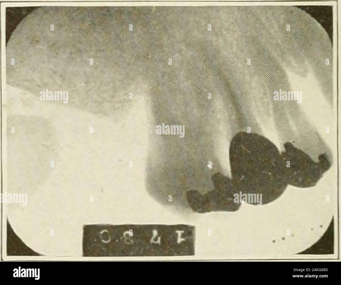 General and dental pathology with special reference to etiology and ...