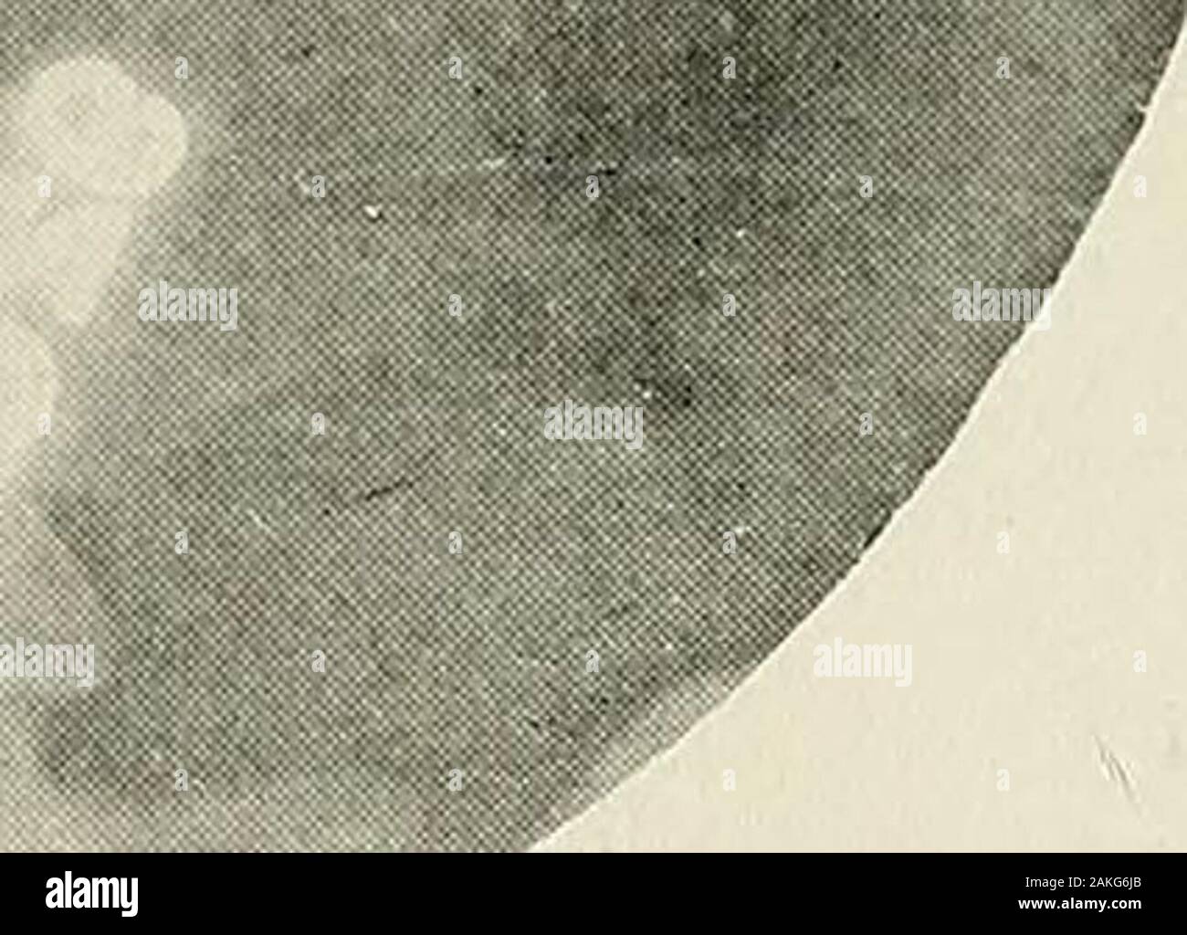 Pyelography (pyelo-ureterography) a study of the normal and pathologic ...