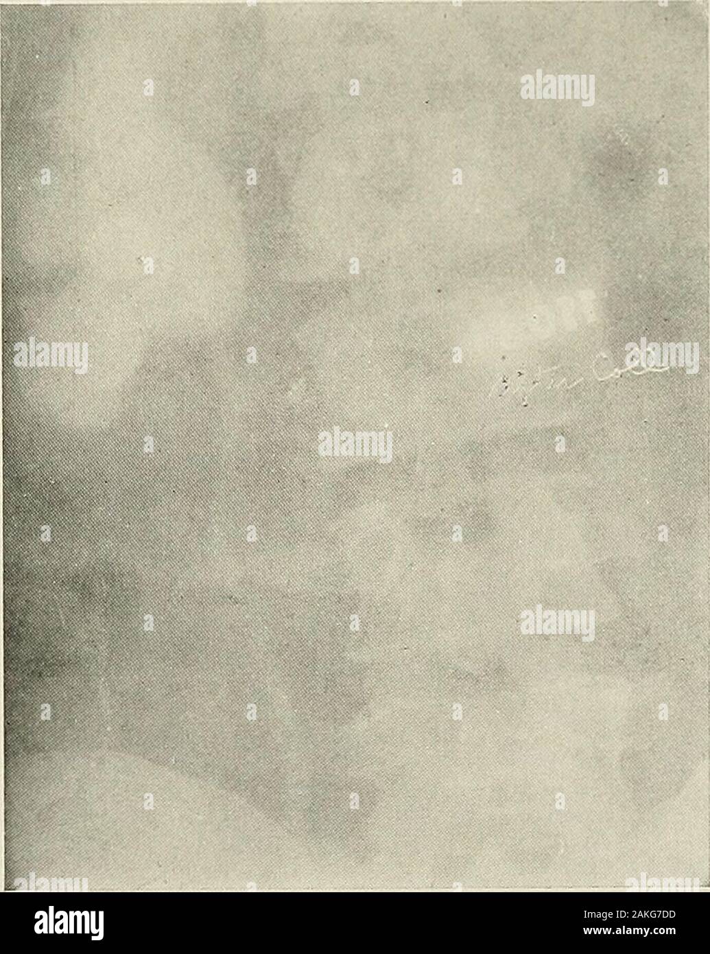 Pyelography (pyelo-ureterography) a study of the normal and pathologic ...