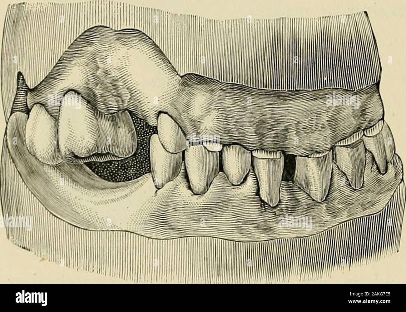 A practical treatise on mechanical dentistry . crowns of the frontteeth ...