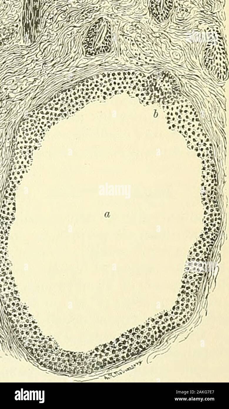 An American text-book of genito-urinary diseases, syphilis and diseases ...