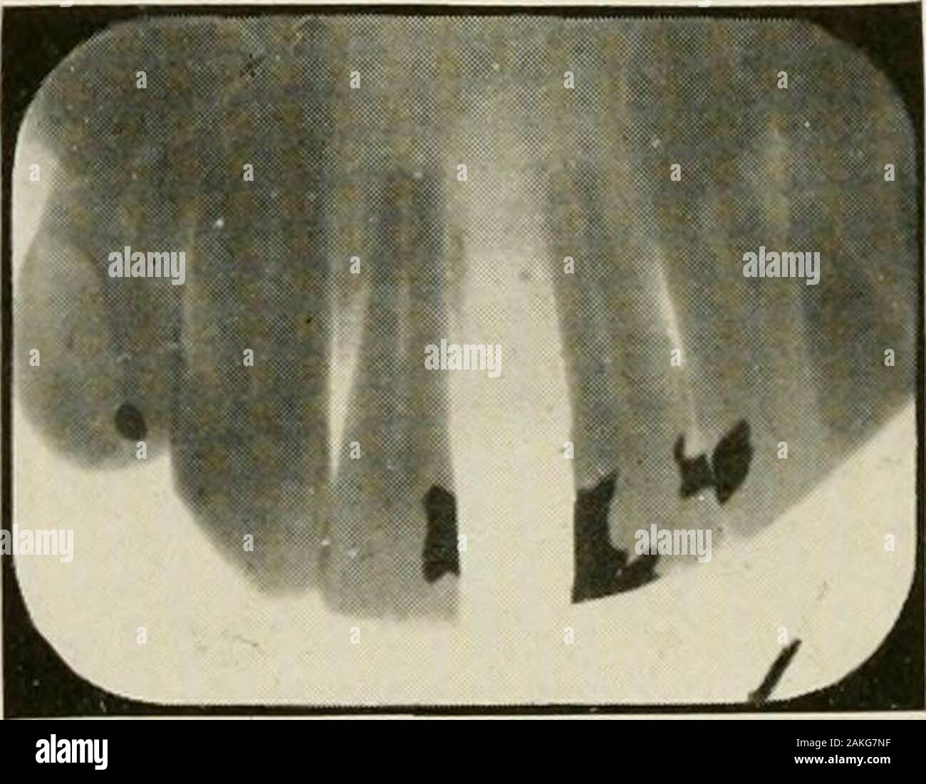 Apical membrane hi-res stock photography and images - Alamy