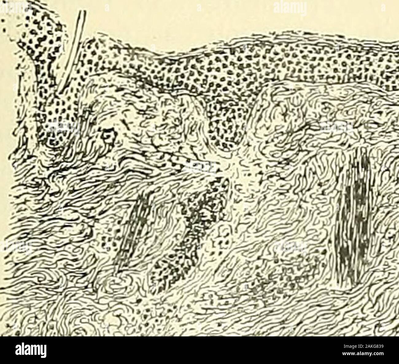 Pinhead Size High Resolution Stock Photography and Images - Alamy