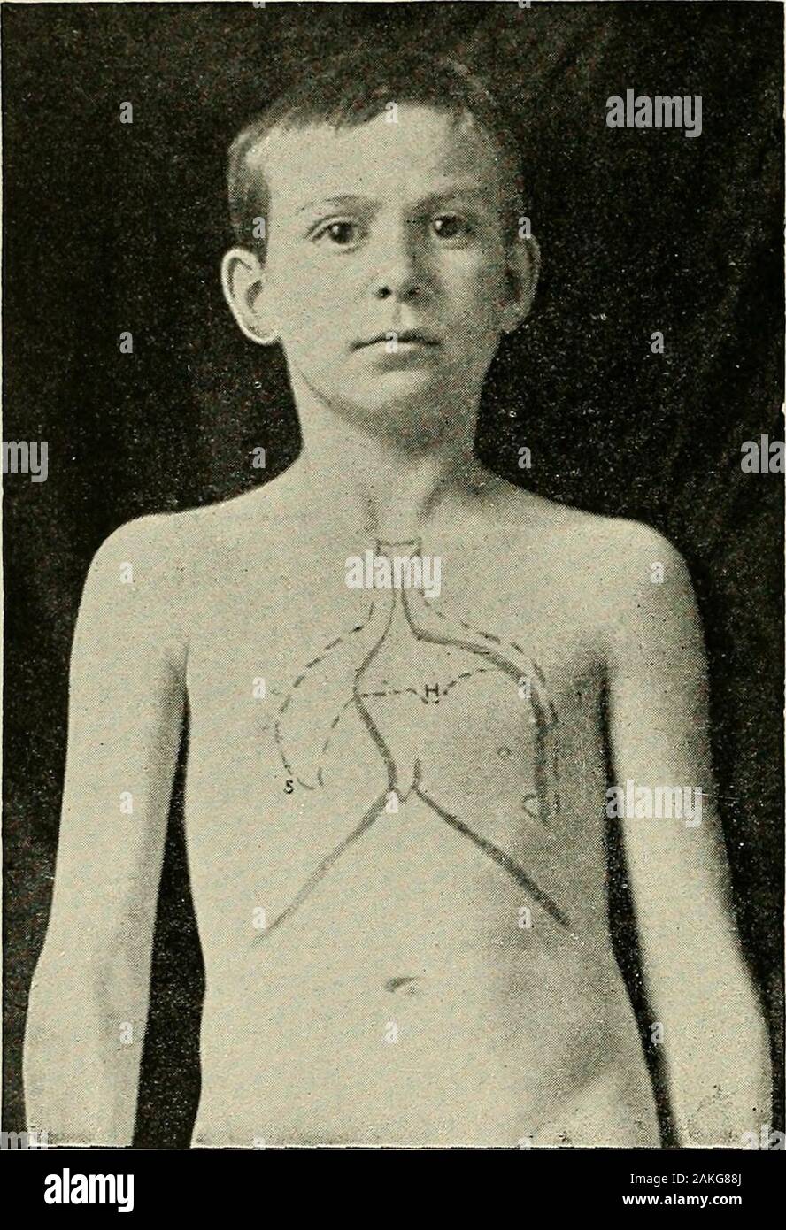 Pediatrics : the hygienic and medical treatment of children . ment of ...