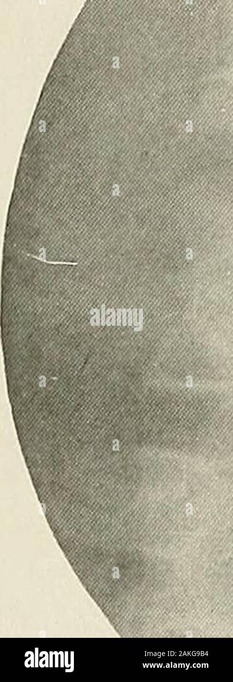 Pyelograms High Resolution Stock Photography and Images - Alamy