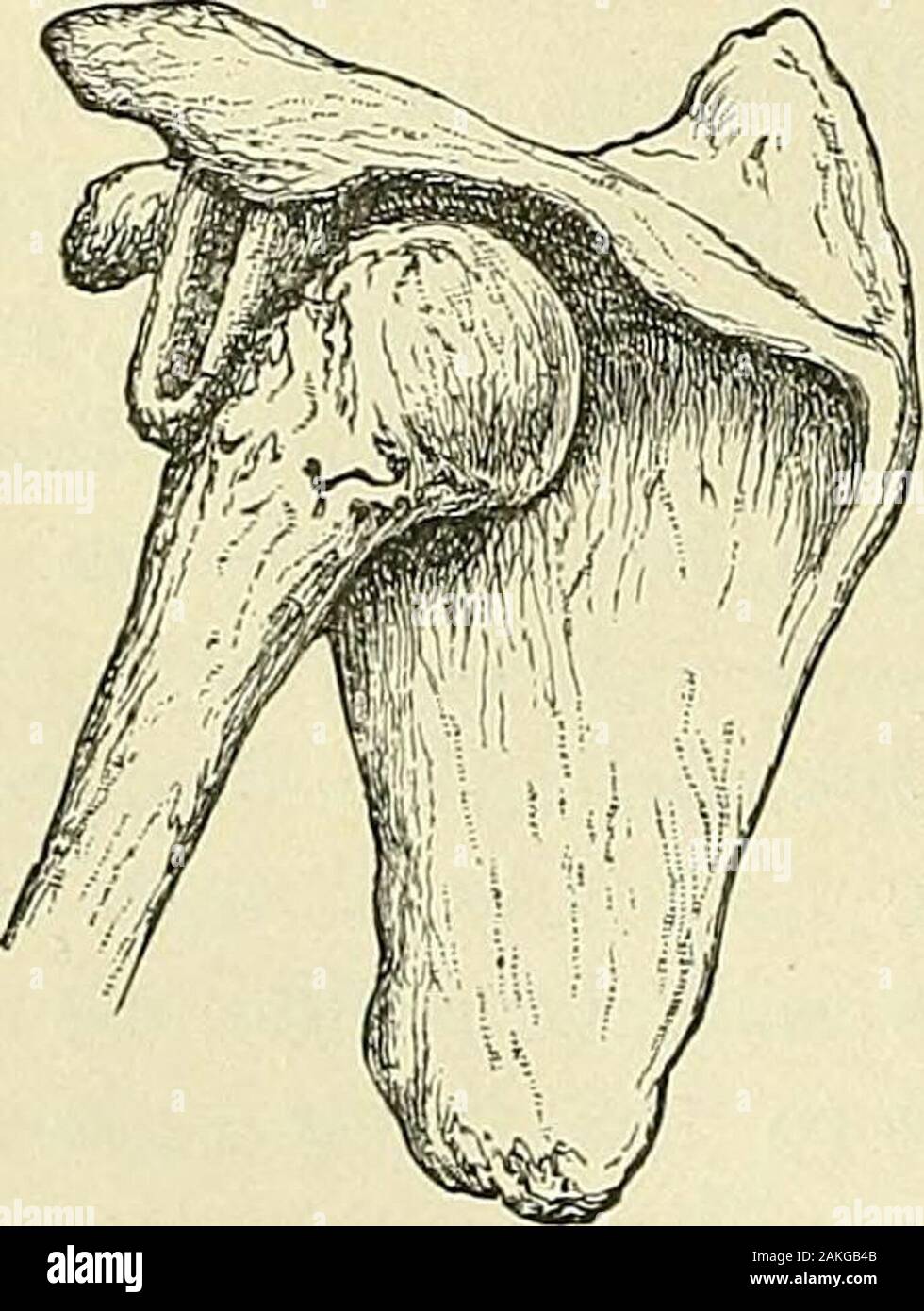 Coracoid process hi-res stock photography and images - Alamy