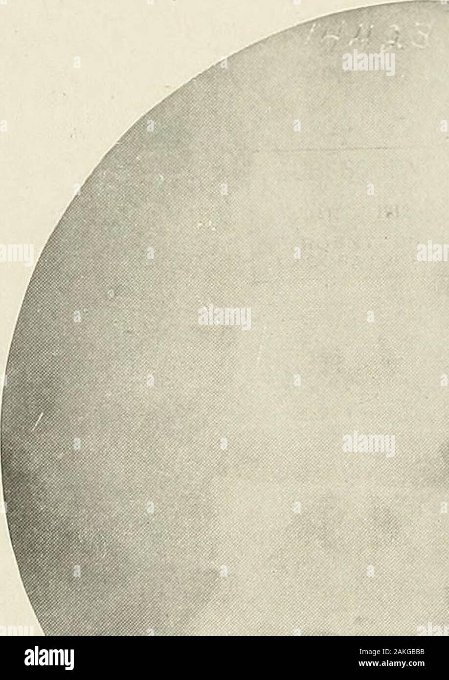 Pyelography (pyelo-ureterography) a study of the normal and pathologic ...