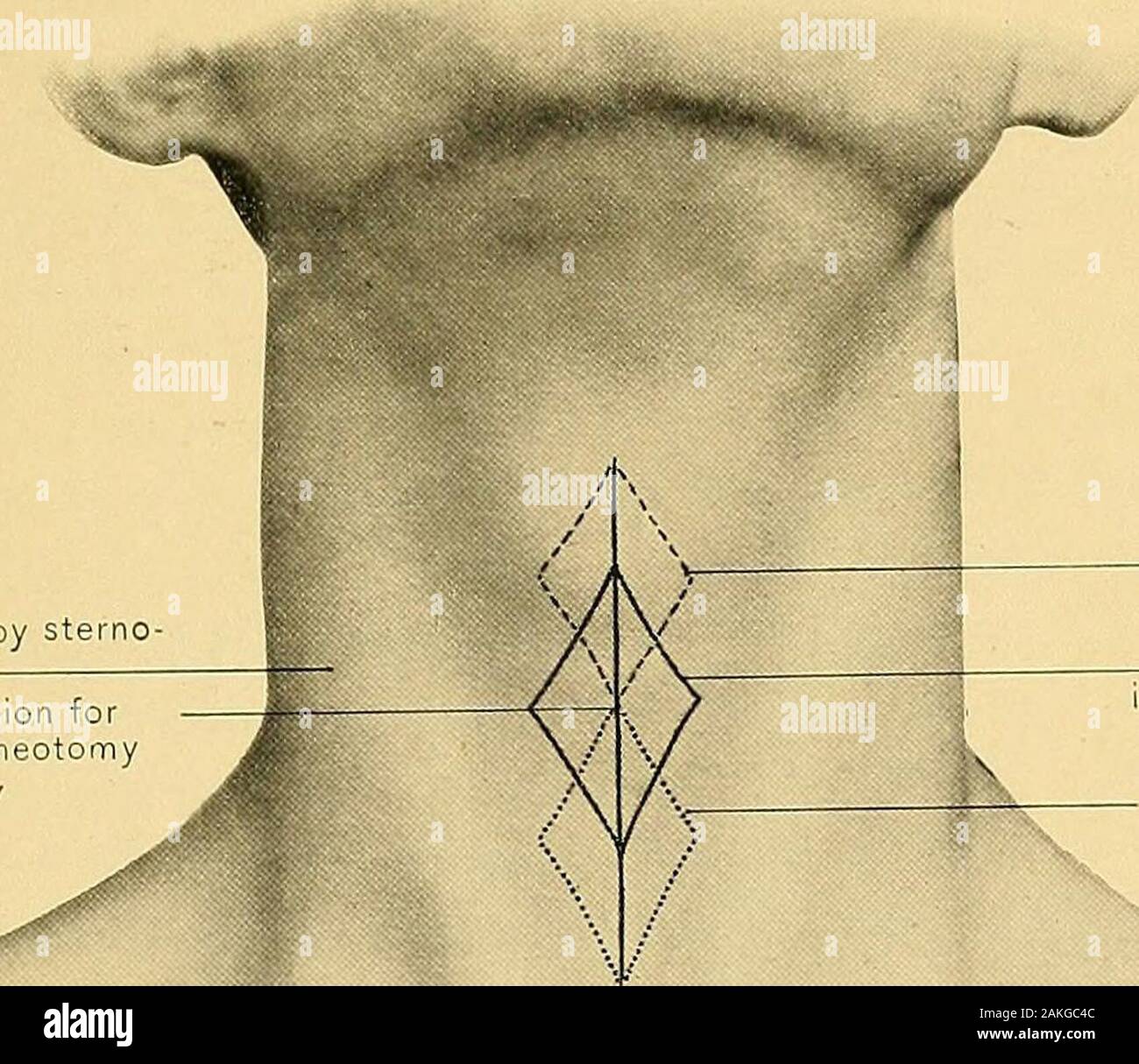 Surgical anatomy : a treatise on human anatomy in its application to ...