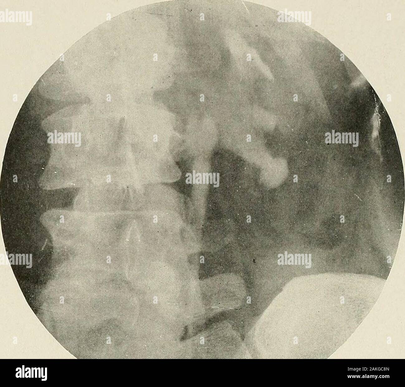 Pyelography (pyelo-ureterography) a study of the normal and pathologic ...
