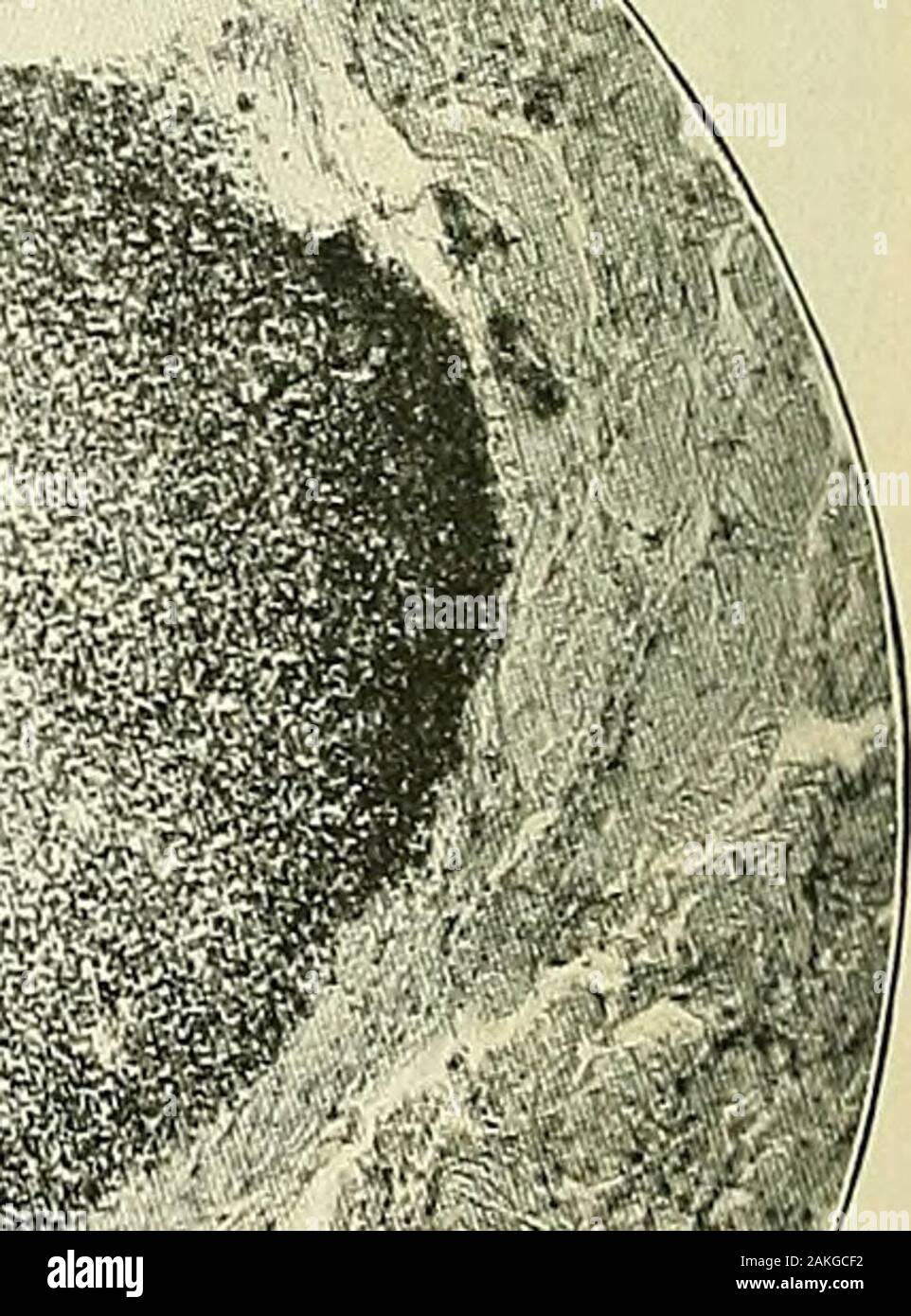An American text-book of genito-urinary diseases, syphilis and diseases ...