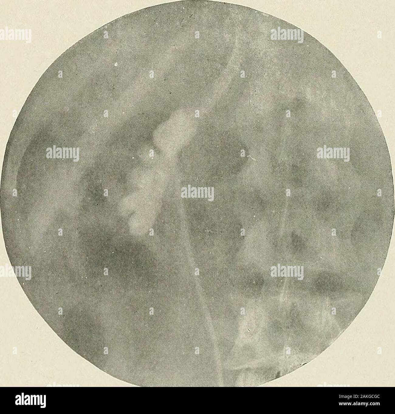 Pyelography (pyelo-ureterography) a study of the normal and pathologic ...