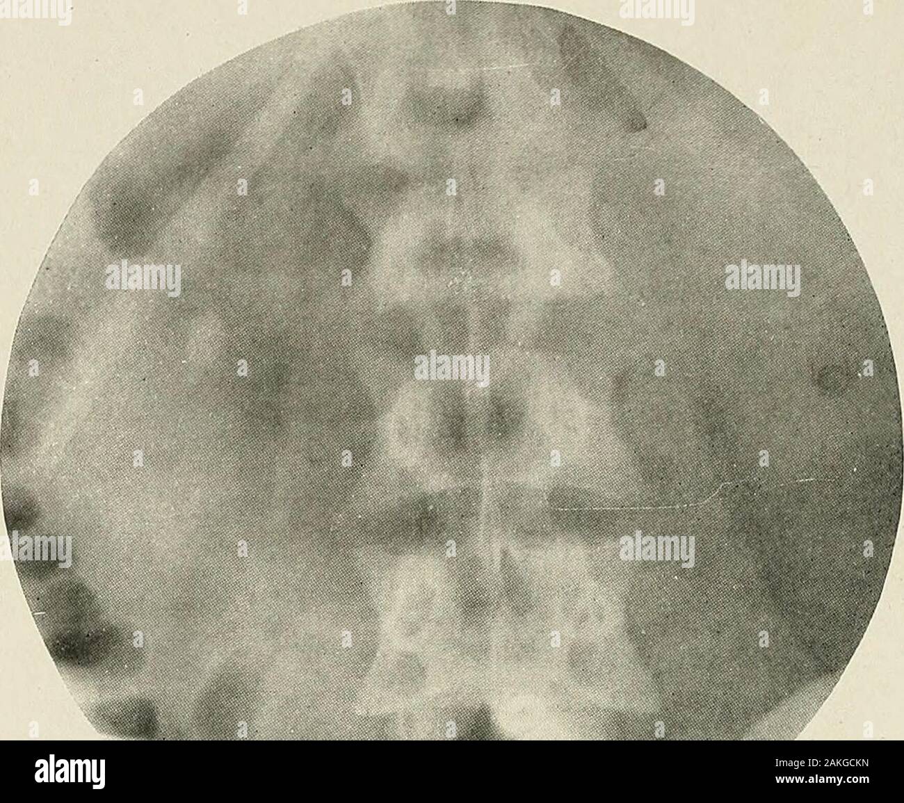 Pyelography (pyelo-ureterography) a study of the normal and pathologic ...
