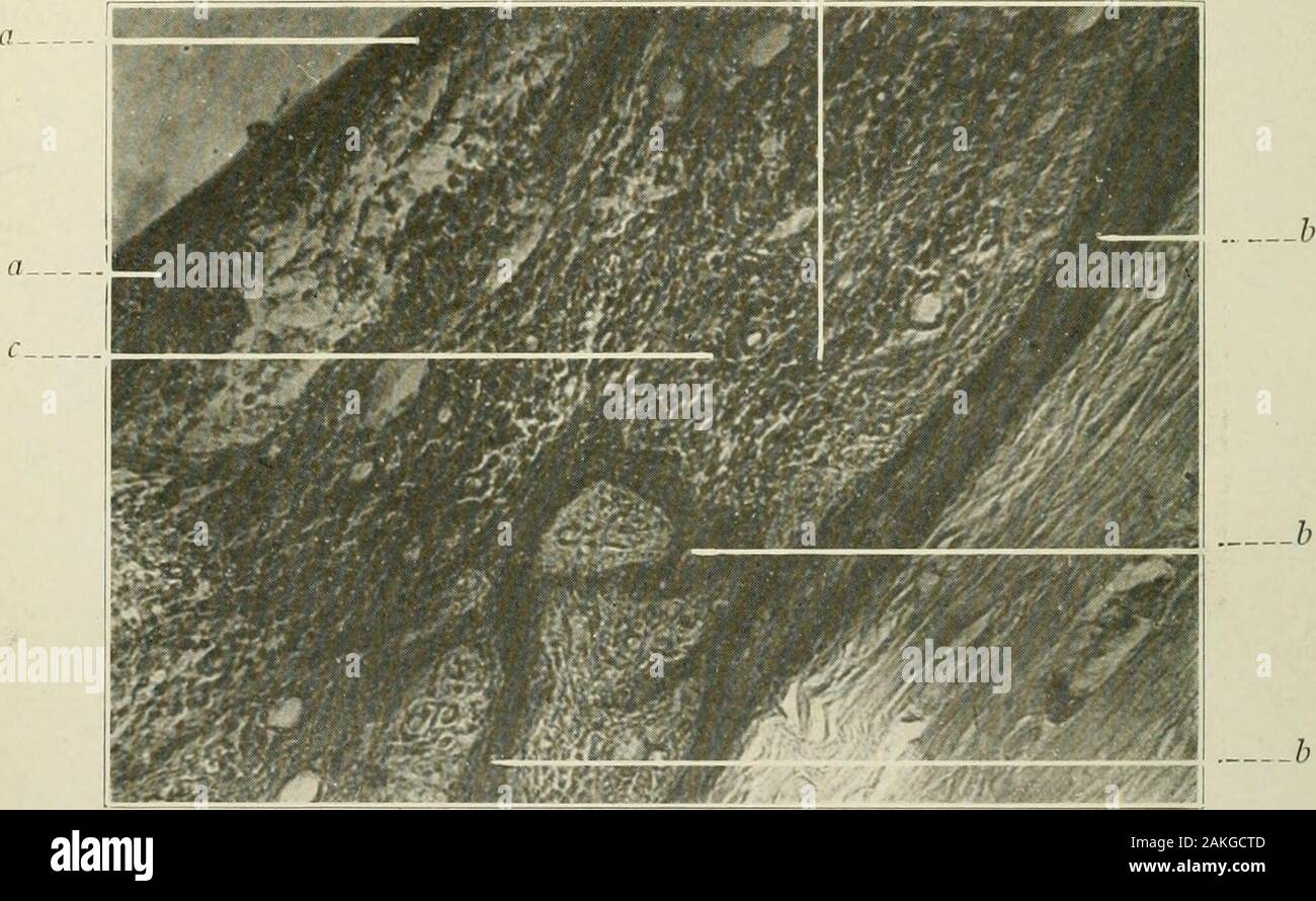 General and dental pathology with special reference to etiology and ...