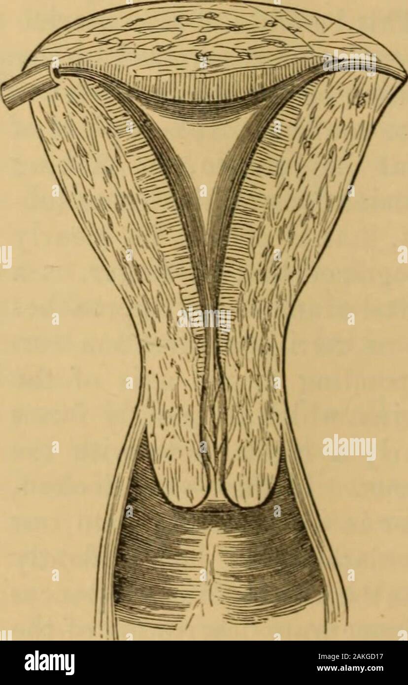 A System of midwifery : including the diseases of pregnancy and the ...