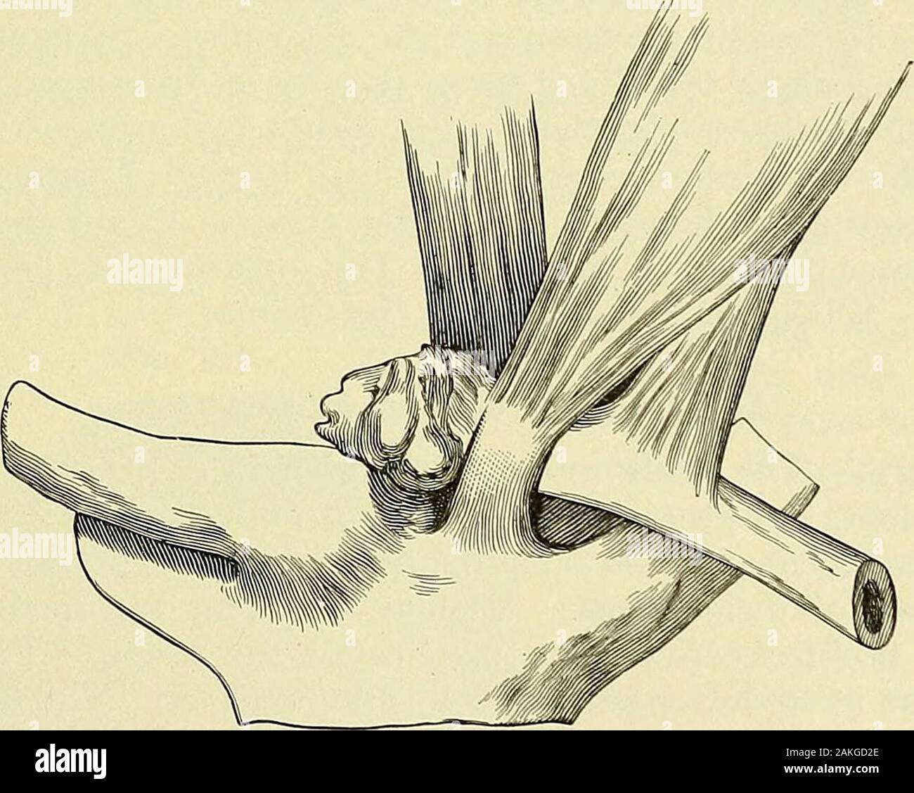 Dislocated knee hi-res stock photography and images - Alamy