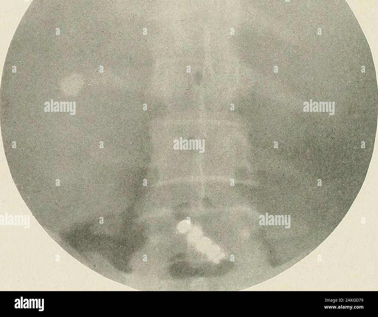Pyelography (pyelo-ureterography) a study of the normal and pathologic ...