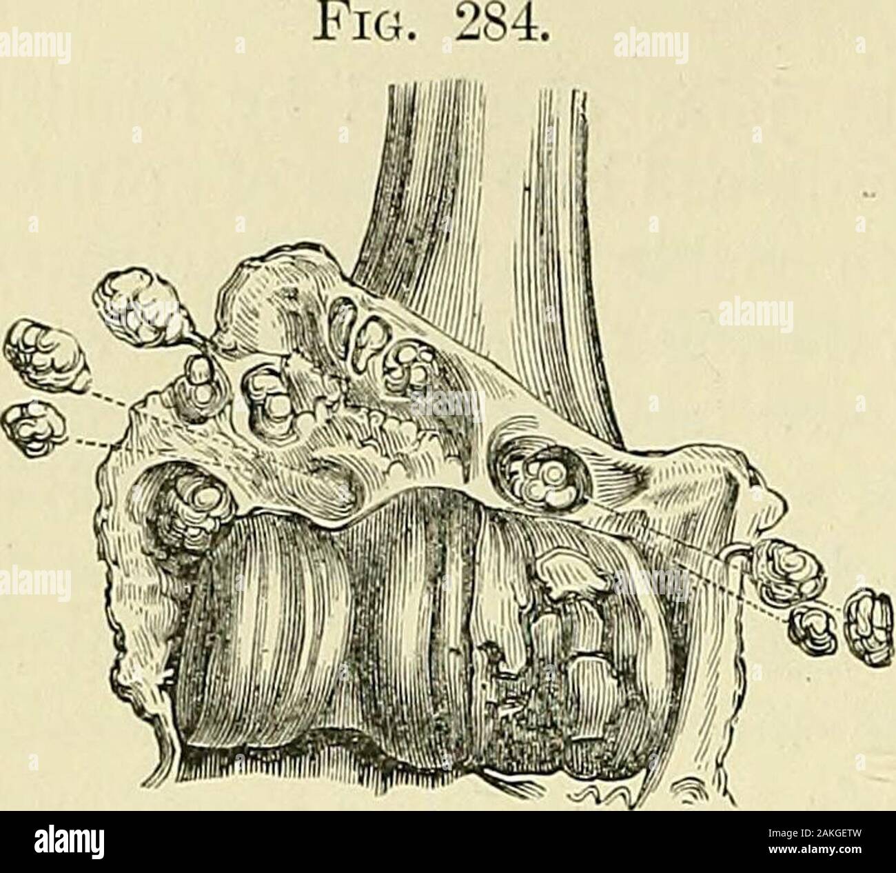 False knee hi-res stock photography and images - Alamy