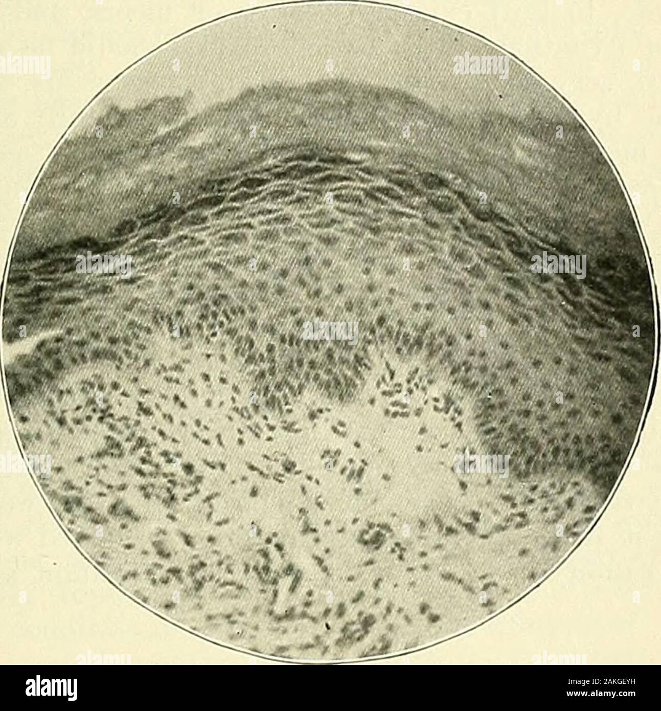 An American text-book of genito-urinary diseases, syphilis and diseases ...
