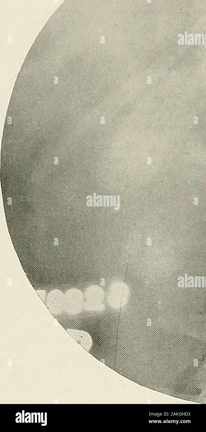Pyelography (pyelo-ureterography) a study of the normal and pathologic ...