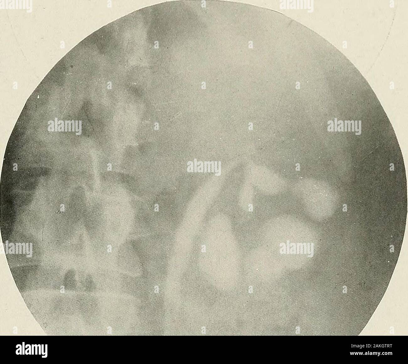 Pyelography (pyelo-ureterography) a study of the normal and pathologic ...