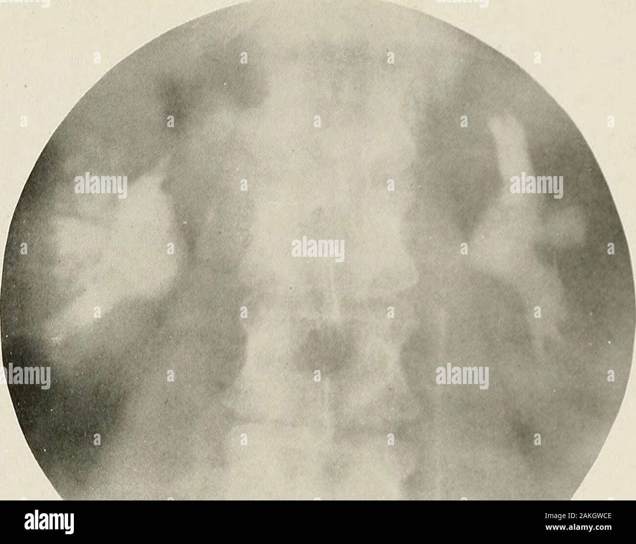 Pyelography (pyelo-ureterography) a study of the normal and pathologic ...