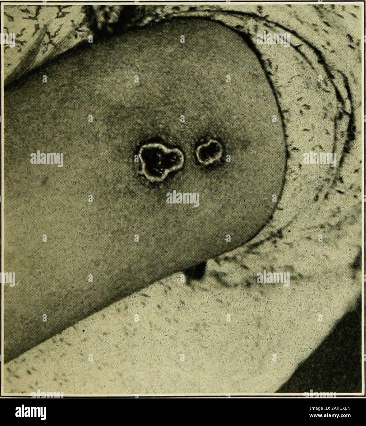 100 ses hi-res stock photography and images - Alamy