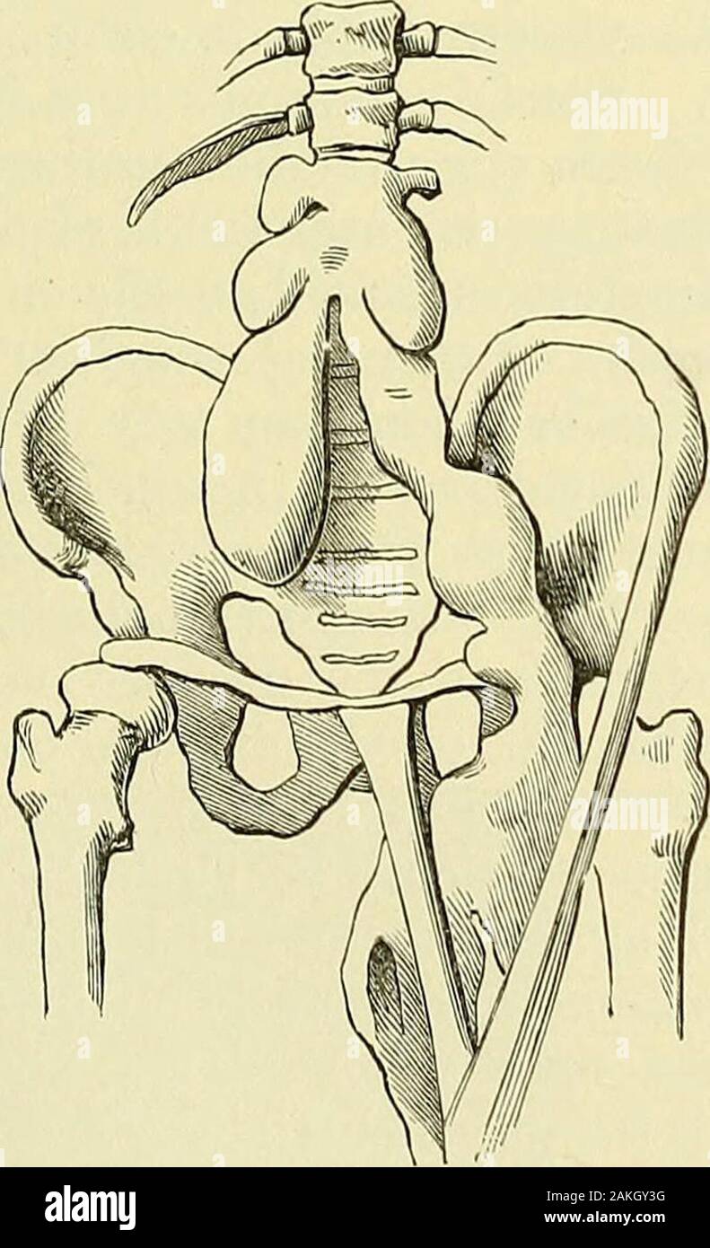 Psoas muscles hi-res stock photography and images - Alamy