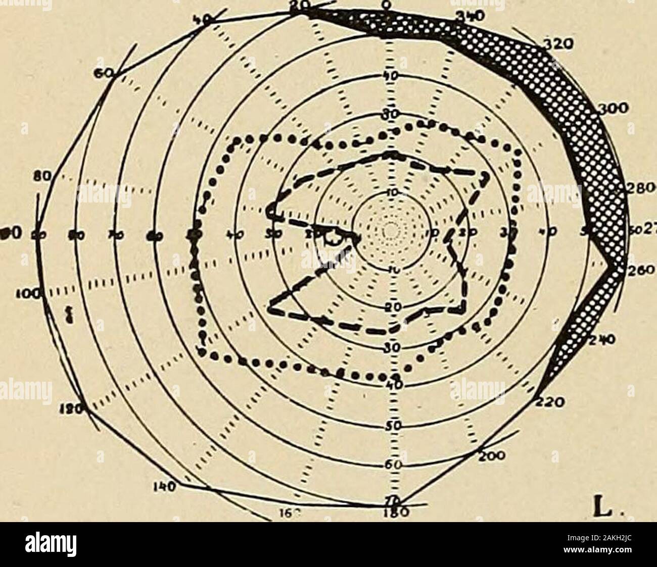 Scotoma hi-res stock photography and images - Alamy