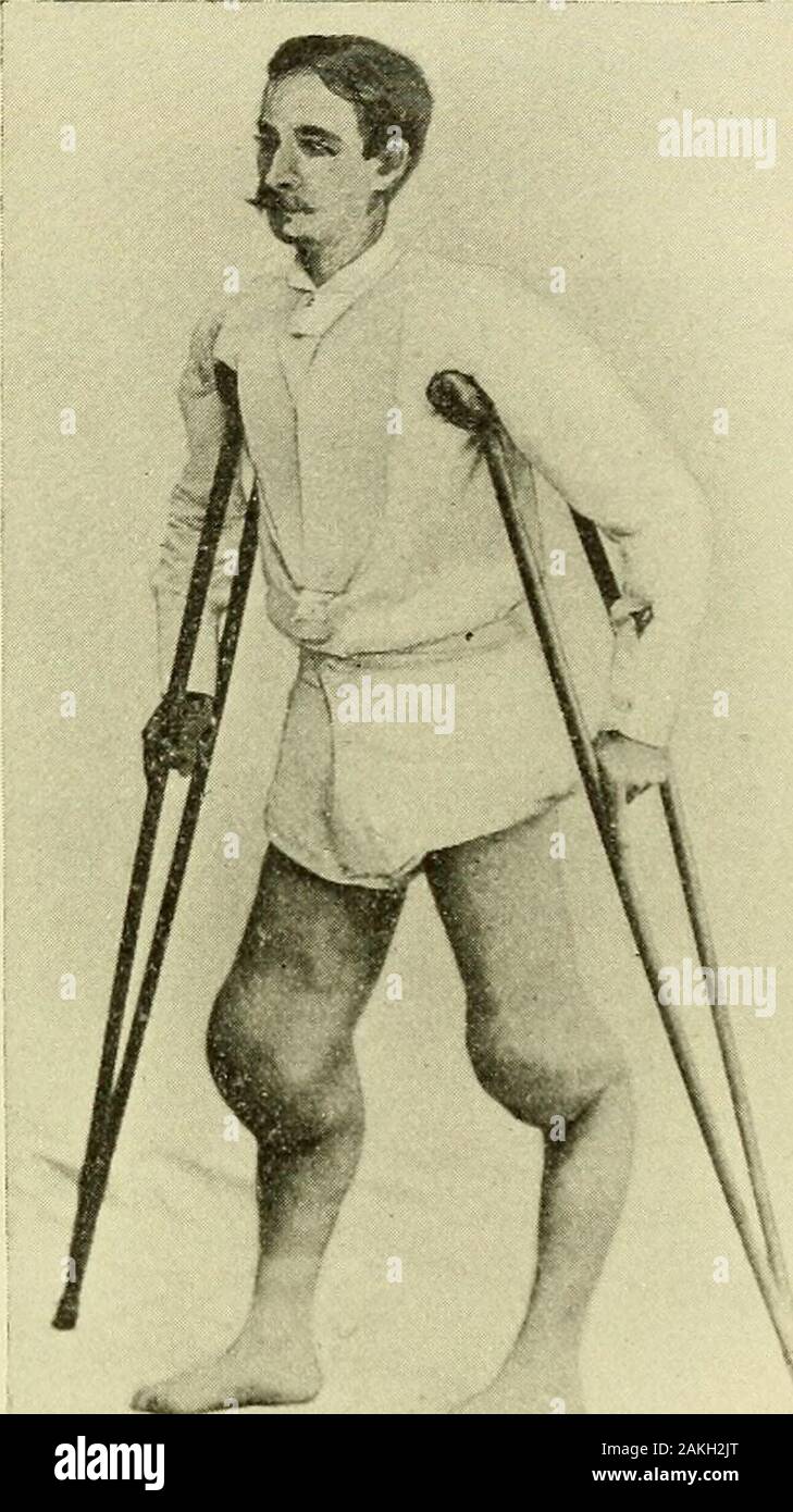 Trophic changes hi-res stock photography and images - Alamy