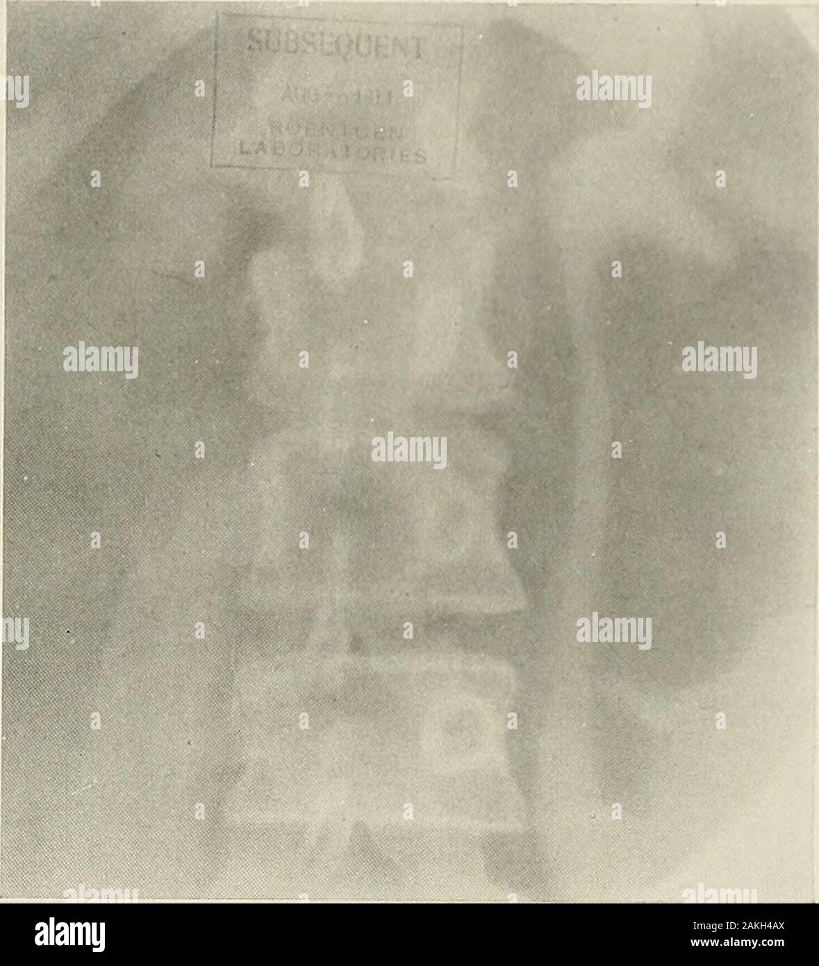 Pyelography (pyelo-ureterography) a study of the normal and pathologic ...
