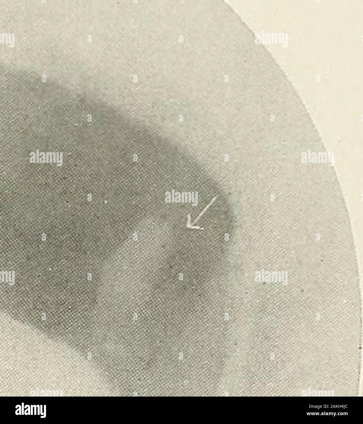 Pyelography (pyelo-ureterography) a study of the normal and pathologic ...
