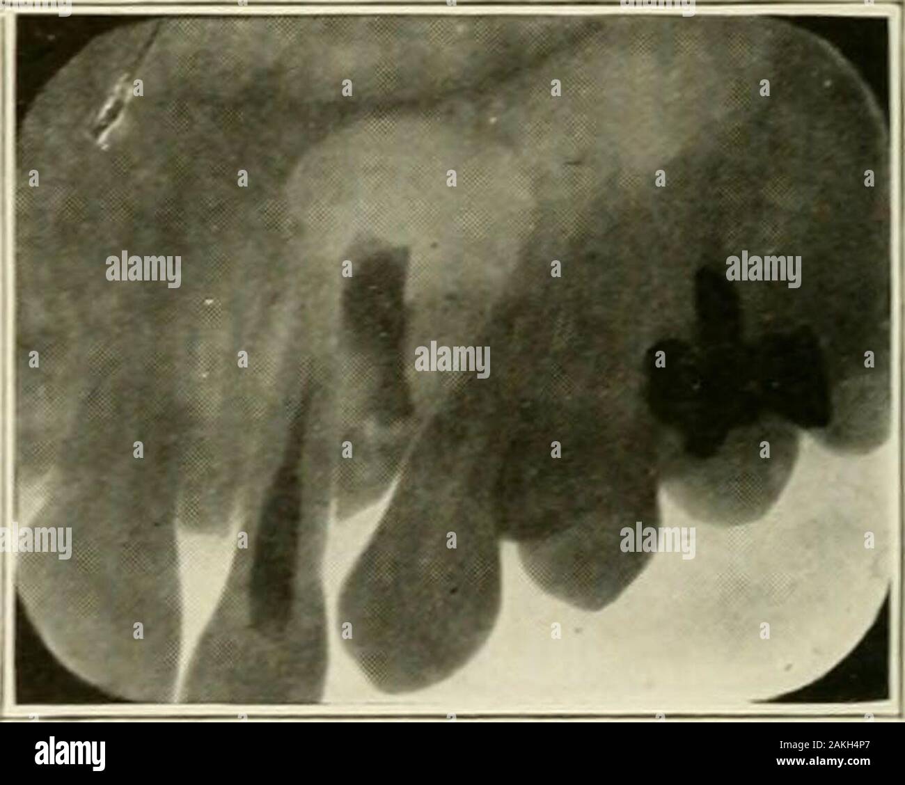 General and dental pathology with special reference to etiology and ...