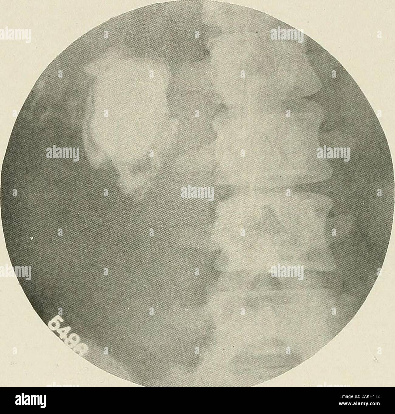 Pyelography (pyelo-ureterography) a study of the normal and pathologic ...