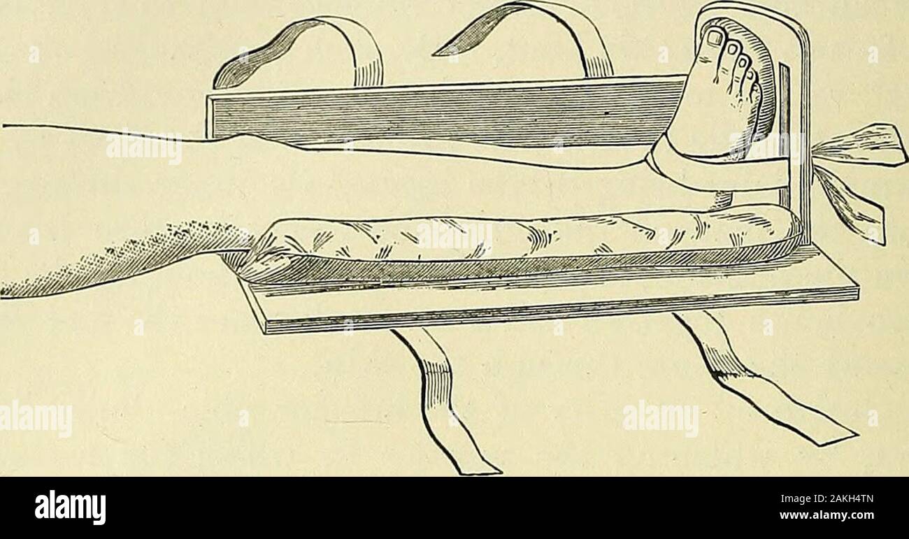 Tarsal joints hi-res stock photography and images - Alamy