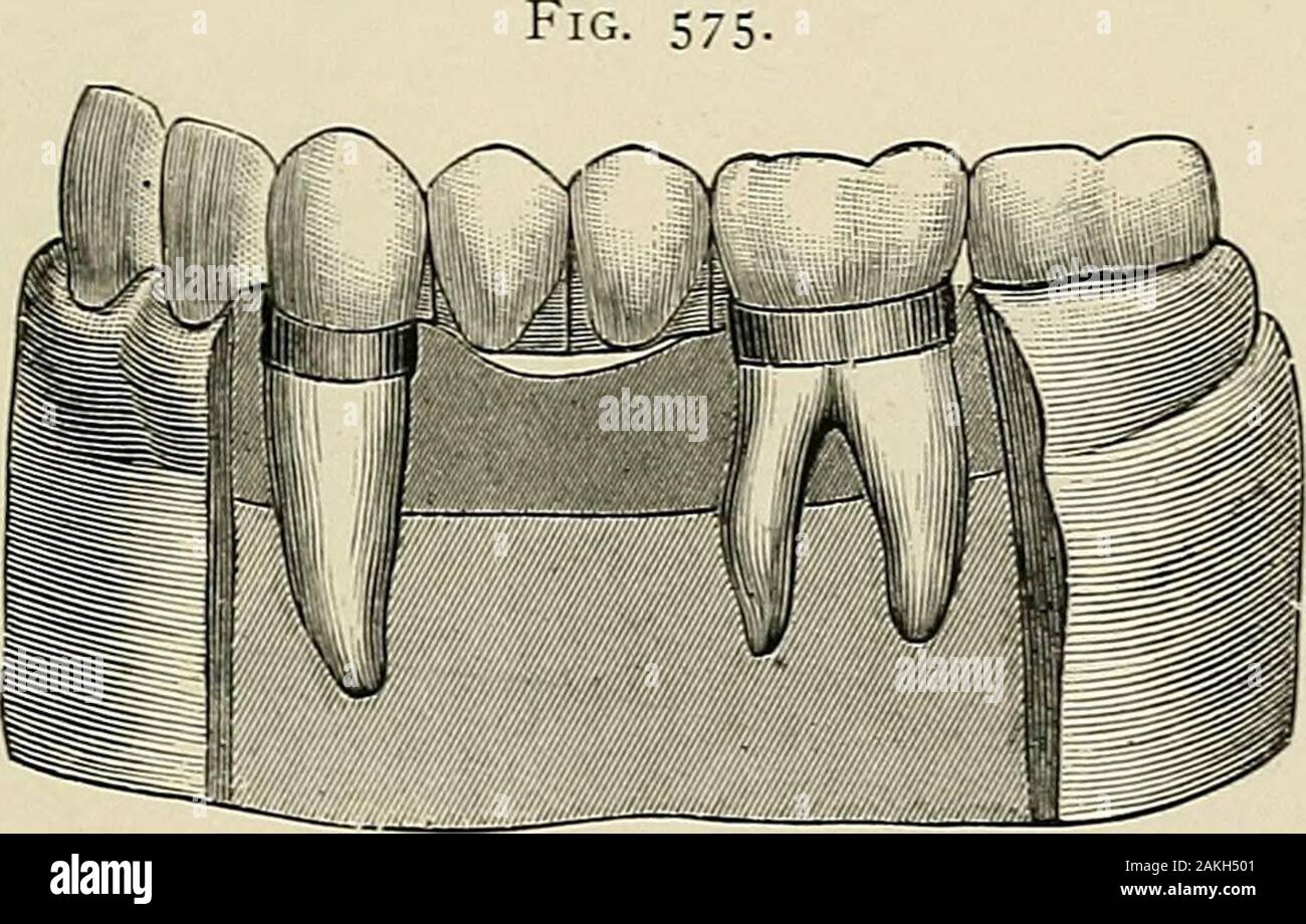 Gold amalgam hi-res stock photography and images - Alamy