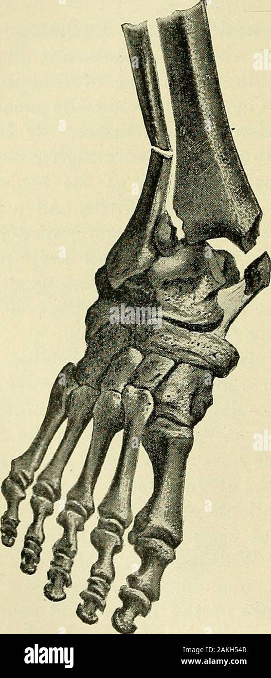 A manual of modern surgery : an exposition of the accepted doctrines ...