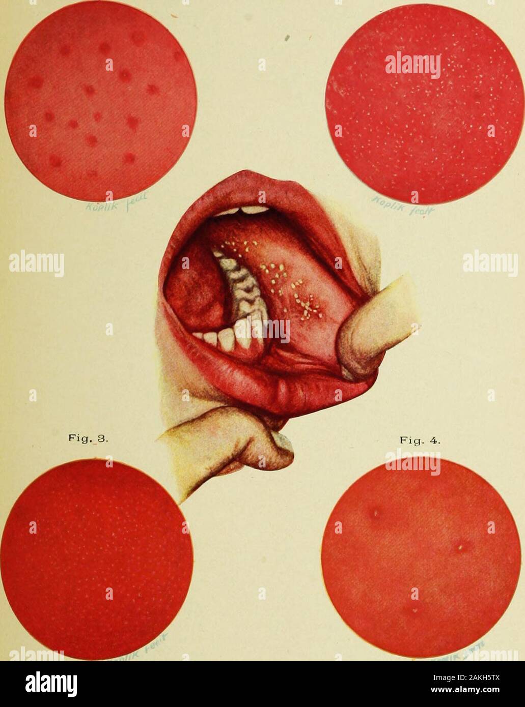 The practice of pediatrics . character, dis-appear on pressure. The ...