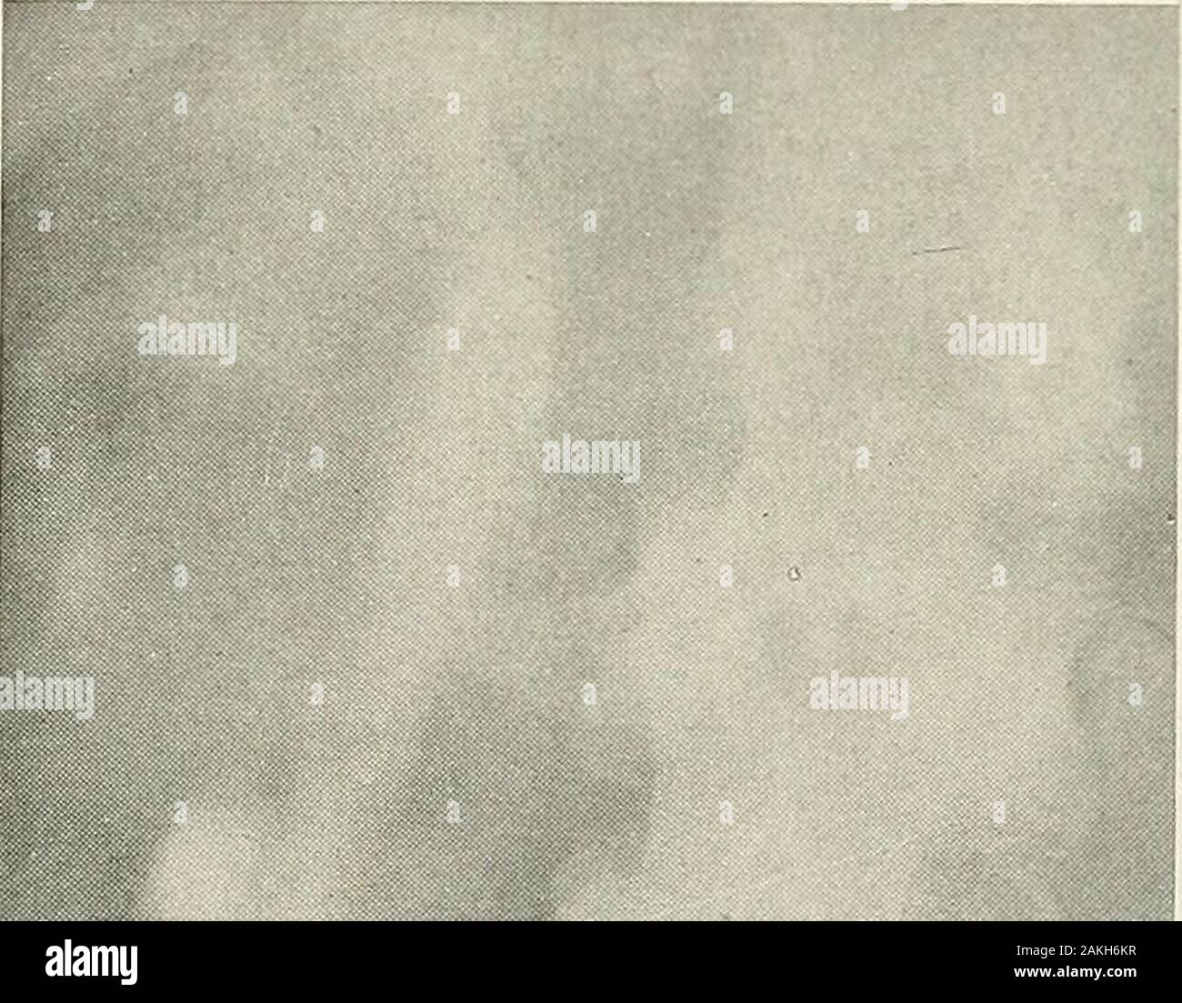 Pyelography (pyelo-ureterography) a study of the normal and pathologic ...