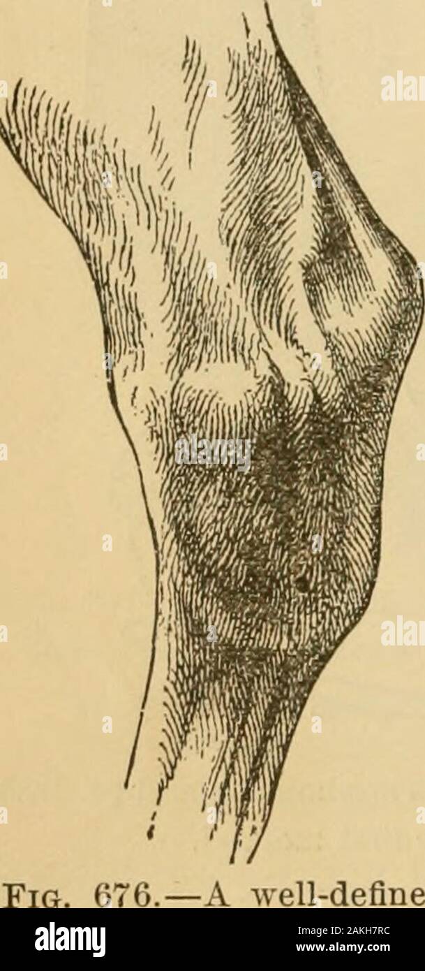 Short pasterns hi-res stock photography and images - Alamy