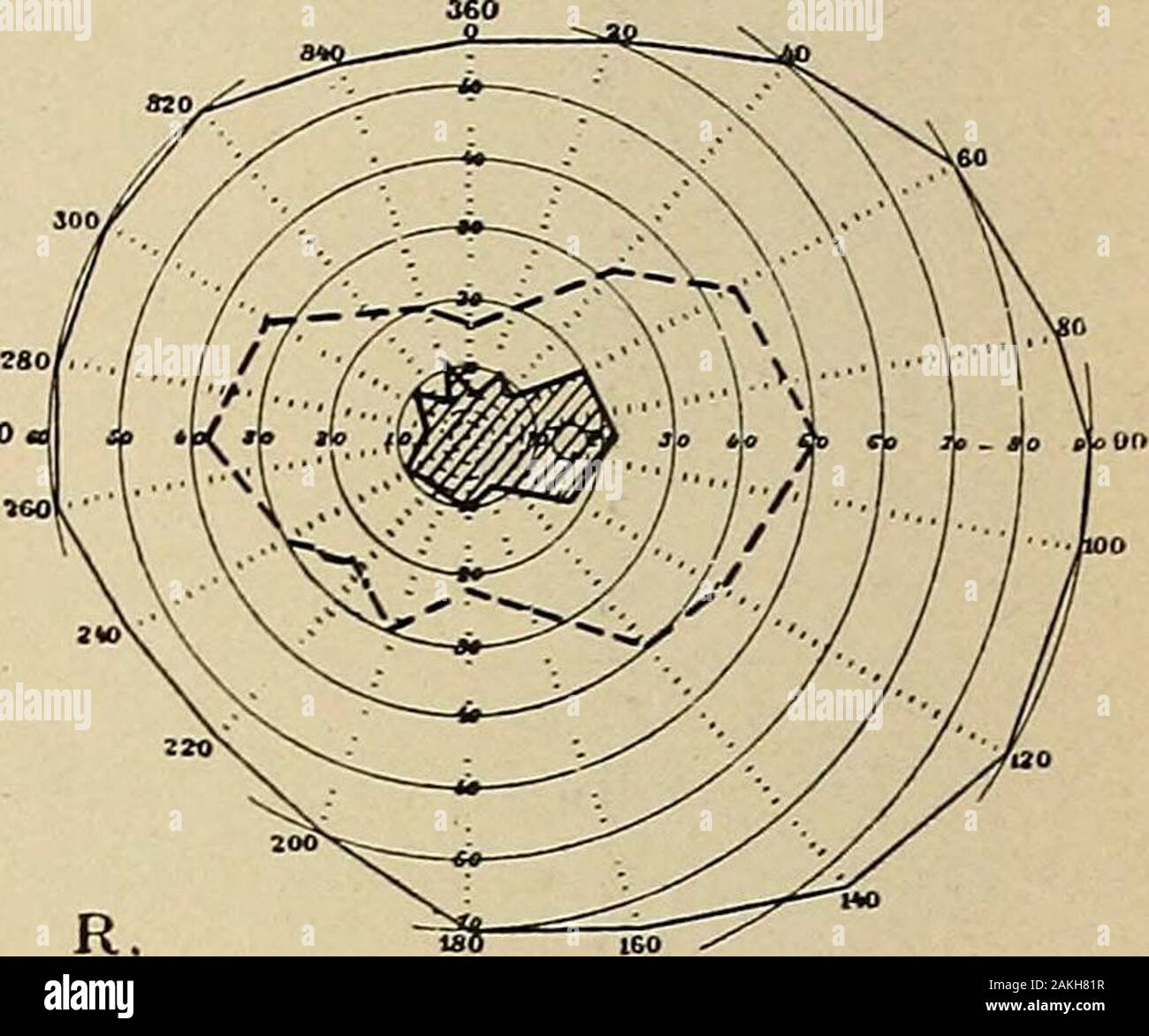 Scotoma hi-res stock photography and images - Alamy