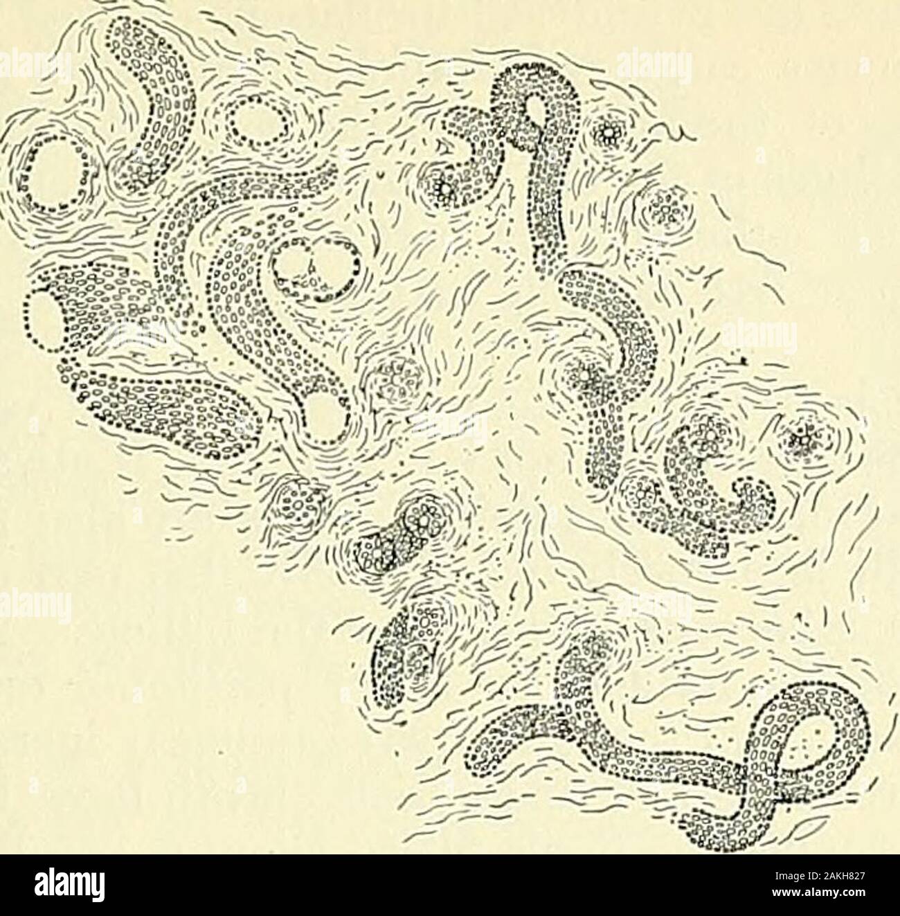 An American text-book of genito-urinary diseases, syphilis and diseases ...