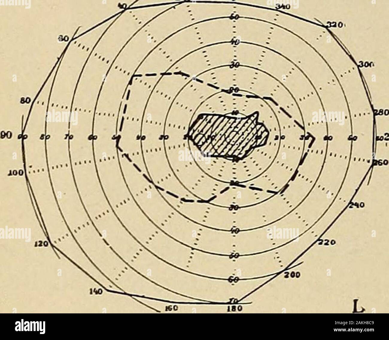 Scotoma hi-res stock photography and images - Alamy